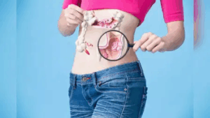 Colon Cancer and Stomach Noises: Key Facts