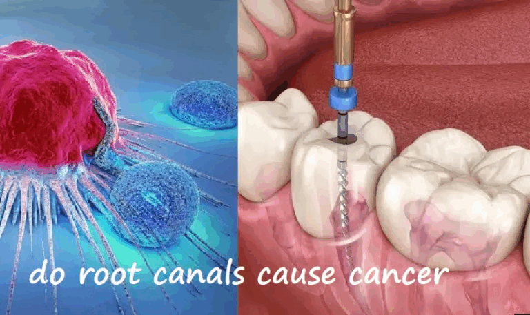 Can Root Canals Cause Cancer? Myths vs. Medical Facts