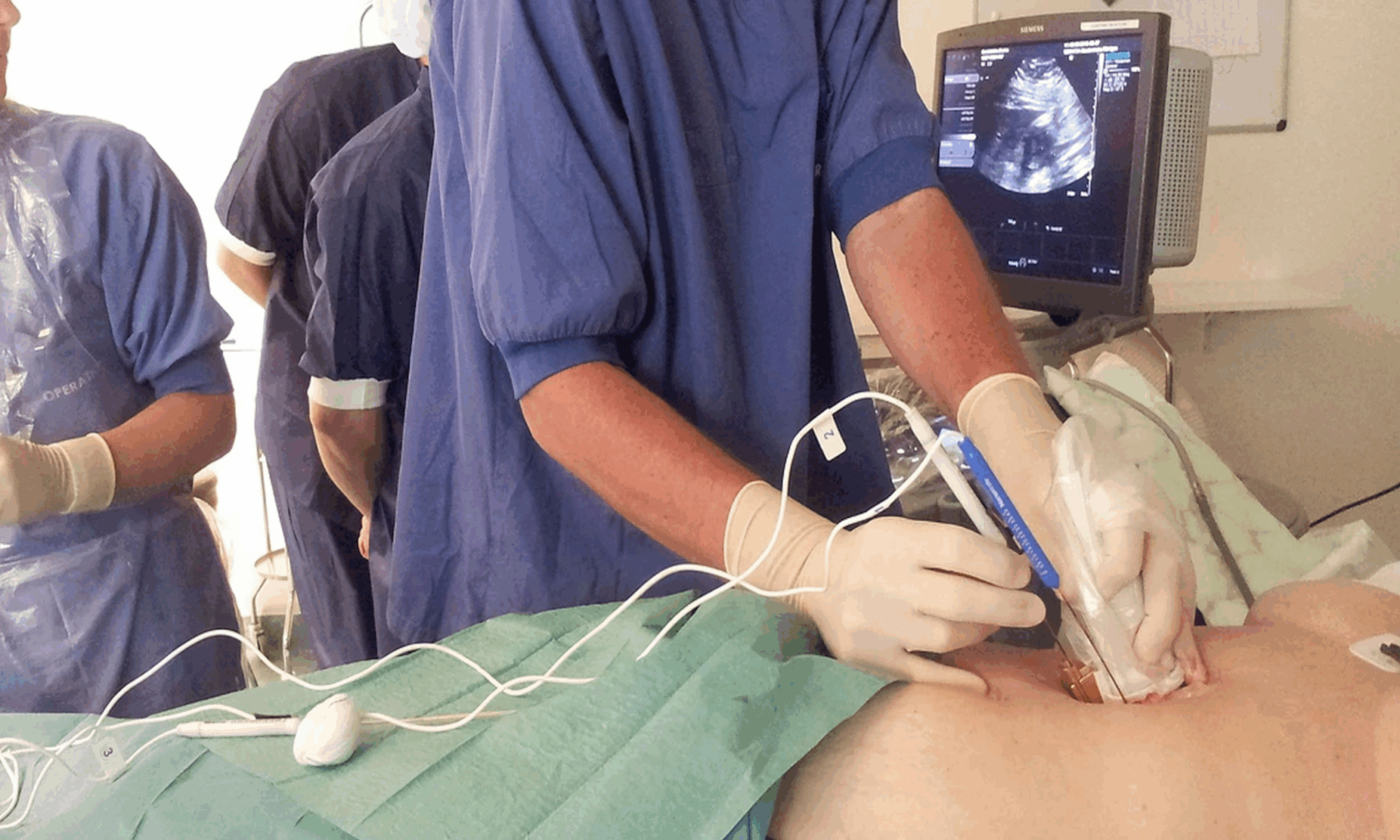 NanoKnife Pancreatic Cancer Treatment: A Comprehensive Guide