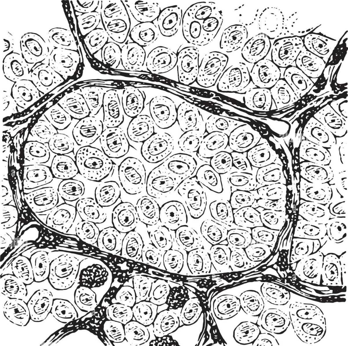 Subcutaneous Lumps in Soft Tissue Sarcoma